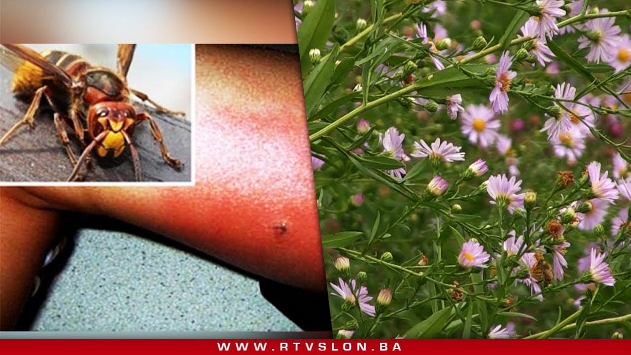 Stršljeni, ose i pčele: Šta učiniti ako smo alergični na njihov ubod ...